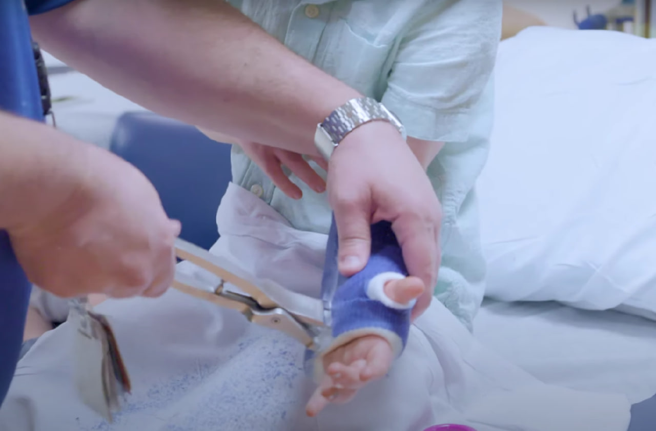 Can Scissors Cut a Cast - Best Saw Guidee